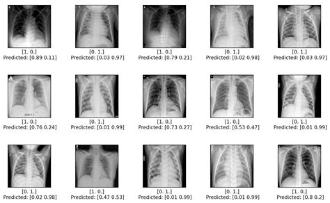 GitHub Sriharivishnu COVID Detection Using A CNN To Detect Covid In Medical Imaging