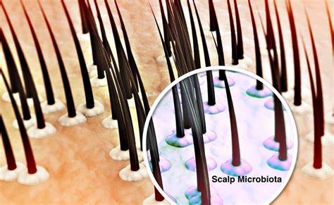 Dry And Oily Scalp Try Out Our Trichoderm Scalp Health Beauty News Asia