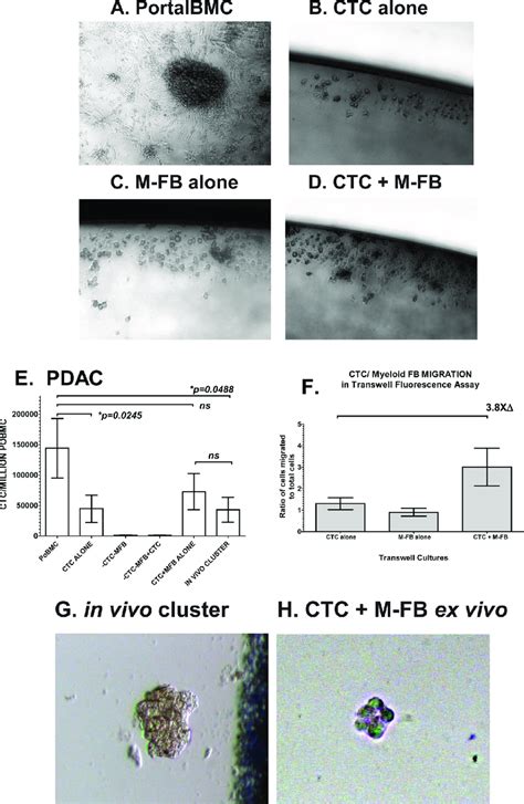 Pdac Ctcm Fb Clusters Promoted Ctc Proliferation And Migration Download Scientific Diagram
