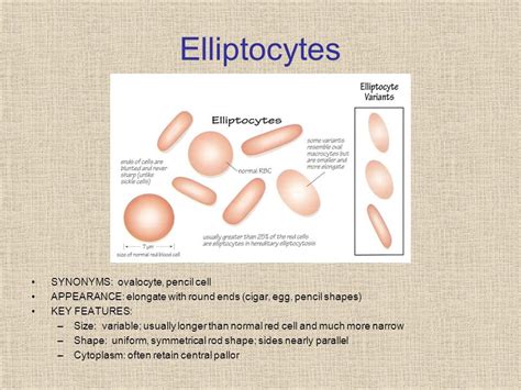Elliptocyte