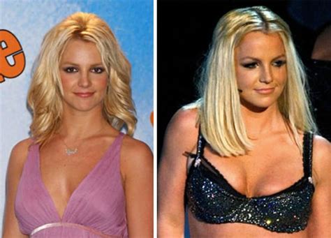Celebrities Before And After Breast Implants