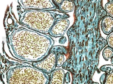 Fucus Microscope Labelled