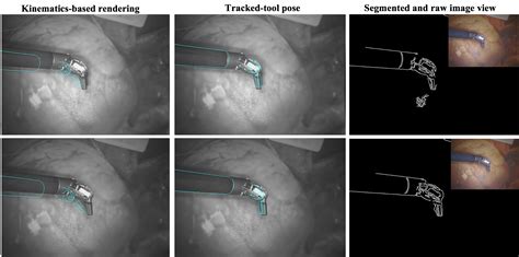 Vision Based Surgical Tool Tracking Ran Hao