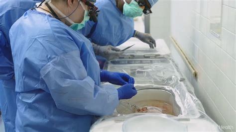 Local12—machine Perfusion Leading To More Organ Viability For Liver Transplants Organ Recovery