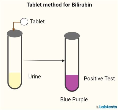 Blood Serum Bilirubin And Urine Bilirubin Tests Normal Range And Result Interpretation