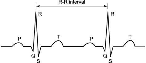 ecg signal and r r intervals download scientific diagram