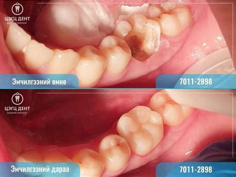 Цэгц Дент шүдний эмнэлэг Home Facebook