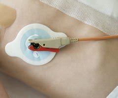 Cardiac Telemetry Like Having A Cardiac Rescue Team In A Box