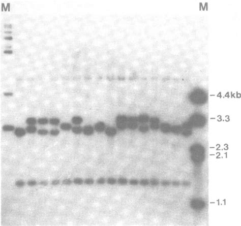 Figure 1 From Characterization Of A Highly Polymorphic Region 5 To Jh