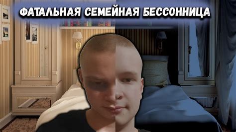Фатальная семейная бессонница фото больных людей