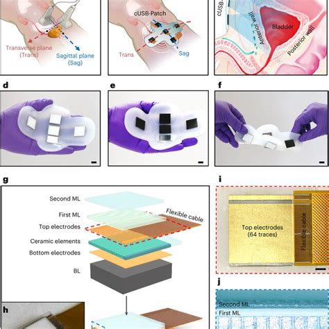 A Conformable Phased Array Ultrasound Patch For Bladder Volume