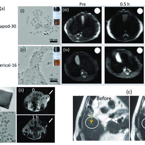 Classification Of Imaging Modes Of Mnps A Major Application A