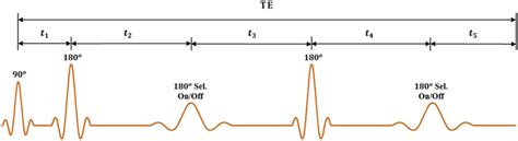 Representative Meshchergarwood Point Resolved Spectroscopy Mega Press