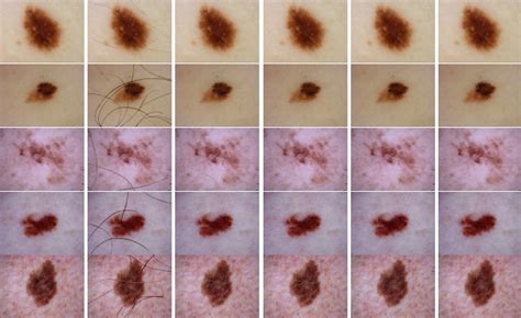 Skin Hair Dataset Shd