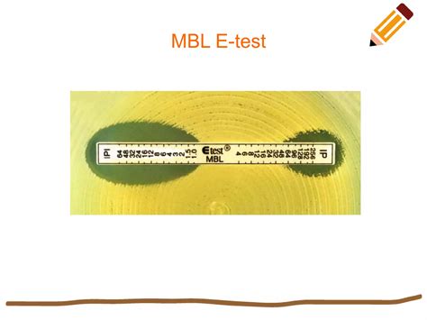 Esbl And Mbl Method Of Detection 1 Pptx