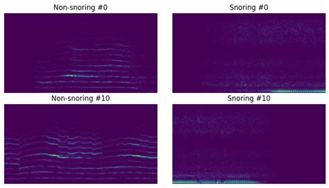 Examples Of Snoring Waveforms Blue And Non Snoring Waveforms