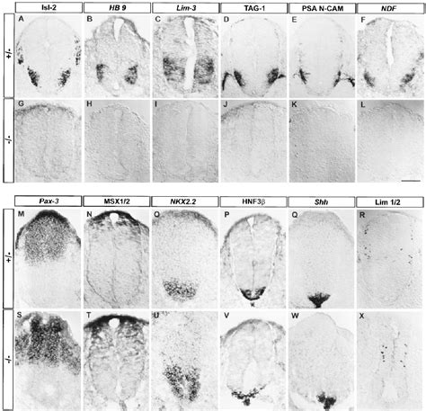 Neuron Differentiation Semantic Scholar
