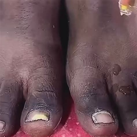 এই ব্লিচ চামড়ার ভিতর থেকে জেদি কালো হাত পা গলা ঘাড় বগল বডি কালো দাগ তুলে সাথে সাথে ফর্সা হবে