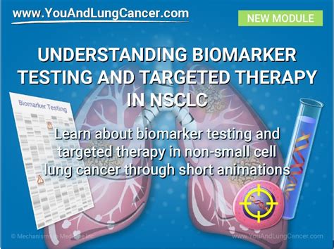 Understanding Biomarker Testing In Nsclc A Breath Of Hope Lung Foundation