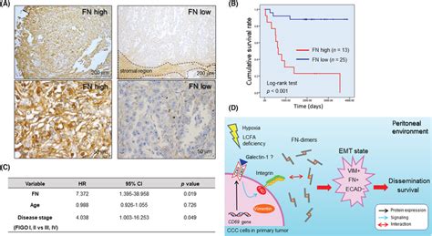 Tumor Cell Fibronectin Fn Is Correlated With The Poor Prognosis Of Download Scientific