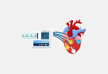 基于Matlab心电信号 ECG 数字信号处理 索炜达 猿创