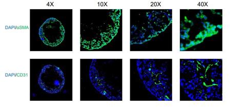 Cardiac Organoid Differentiation Service From Ipsc Creative Bioarray Creative Bioarray