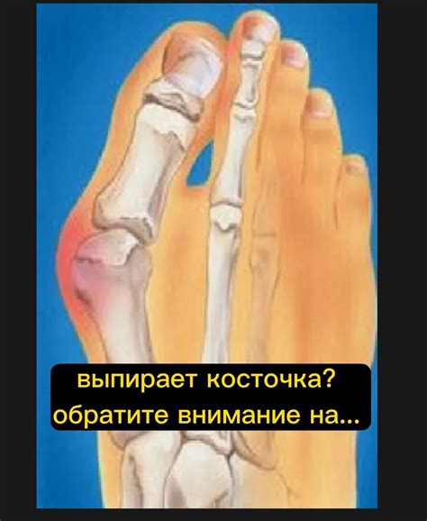 Выпирает косточка на ноге Ролан Сэнсэй Психология самоисцеления Дзен