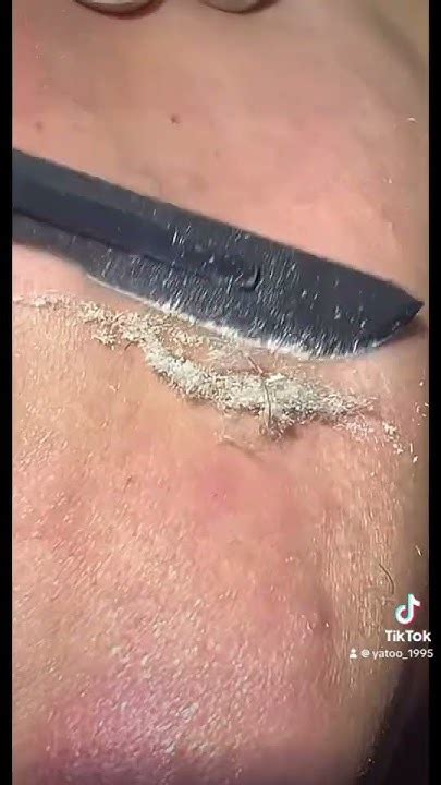 ديرما ديرمابلاننج نضاره وازاله الجلد الميت اكسبلور تجميل Youtube