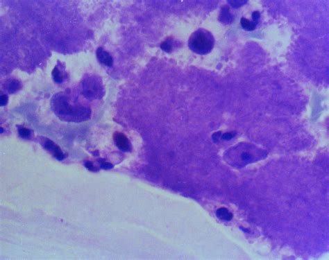Interactions Platelet Research Laboratory