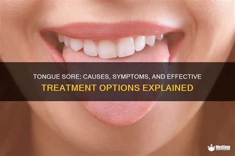 Tongue Sore Causes Symptoms And Effective Treatment Options Explained Medshun