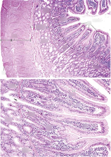 Duodenum Diagram Quizlet