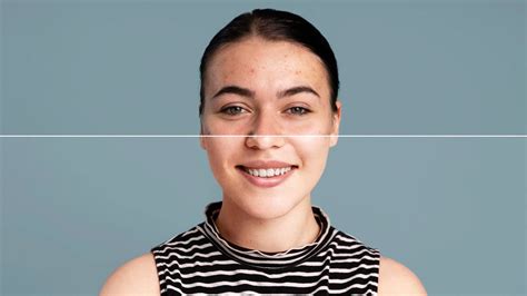 Black Head Tamil Beauty Tips கரும்புள்ளிகள் வர காரணம் Karumpullikal Vara Kaaranam Black