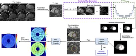 A Deep Learning Segmentation Pipeline For Cardiac T1 Mapping Using Mri