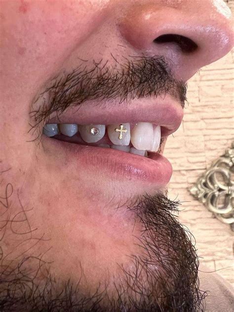 Tooth Gems Tooth Gem Bijoux Dentaire Toothgems Toothjewellry