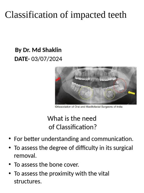 Classification Of Impacted Teeth Pdf Dentistry Tooth