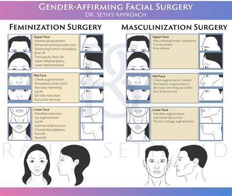 Dr Seth S Ffs And Fms Overview Golden State Plastic Surgery