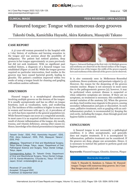 Pdf Fissured Tongue Tongue With Numerous Deep Grooves