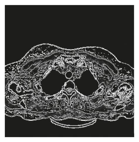 Image Generated By Laplacian Edge Detection Download Scientific Diagram