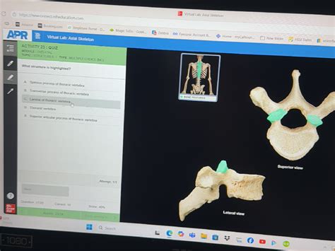 What Structure Is Highlighted A Spinous Studyx