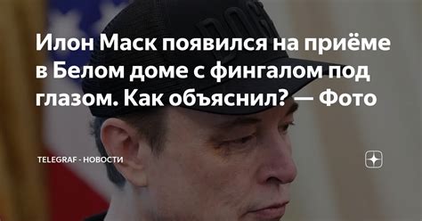 Илон Маск появился на приёме в Белом доме с фингалом под глазом Как