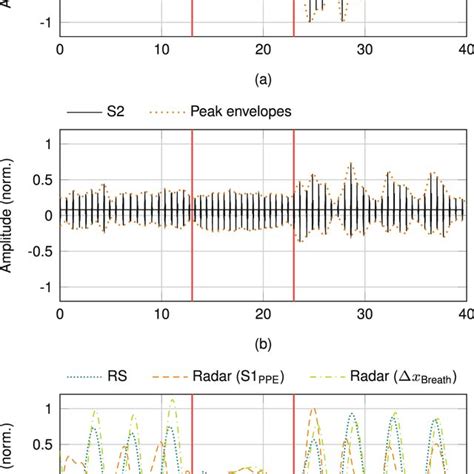 Pdf Radar Based Heart Sound Detection