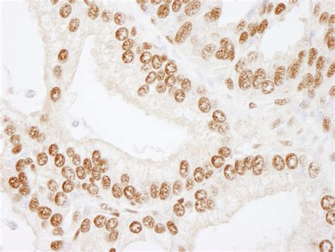 Rabbit Anti Creb Ihc Antibody Fortis Life Sciences
