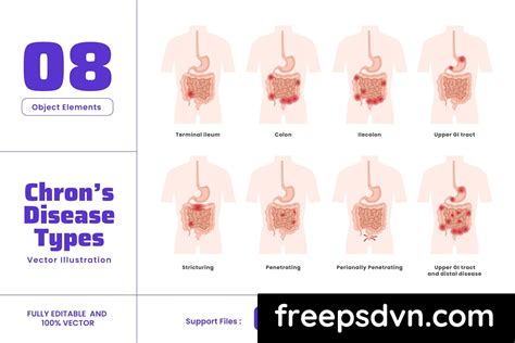 Chrons Disease Human Body Organ Treatment Lgyl2fz Freepsdvn