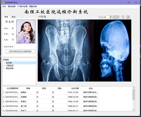qt开源项目：校医院远程诊断系统介绍 qt 实现ct csdn博客