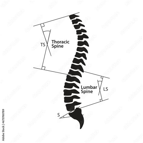 Spinal Pelvic Sagittal Parameters Line Art Vector Illustration Stock