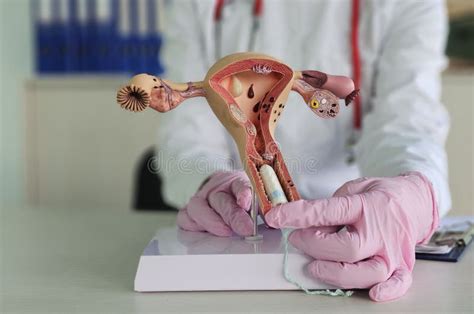 Gynecologist Model Of The Female Reproductive System Uterus Stock