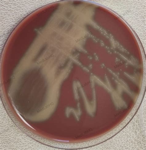 Streptococcus Mitisoralis Medlabhq