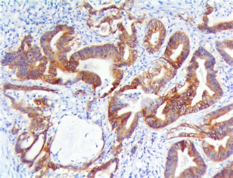C Met Antibody RBT C Met HGFR Bio SB