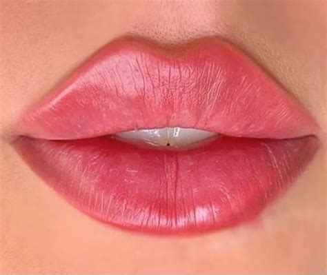 What Is Russian Doll Lip Filler Technique