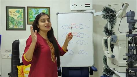 What Is Pseudo Squint Hindi Video After The First 5 Minutes Youtube